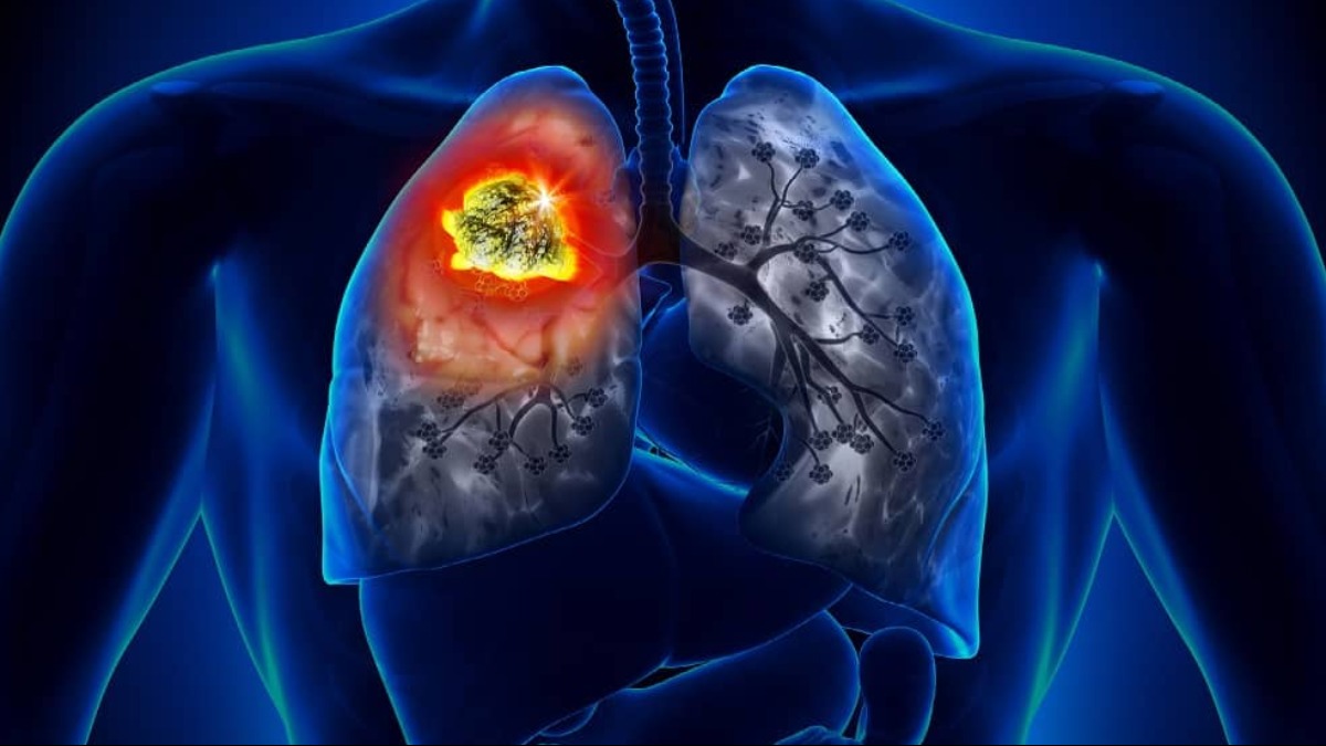 Um a cada cinco jovens de 18 a 24 anos usam cigarro eletrônico no ...